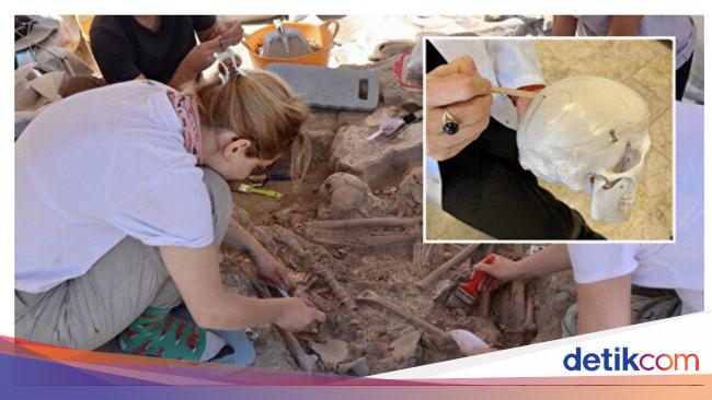 Tengkorak Berlubang Jejak Trepanasi Ditemukan di Turki, Usianya 8.500 Tahun