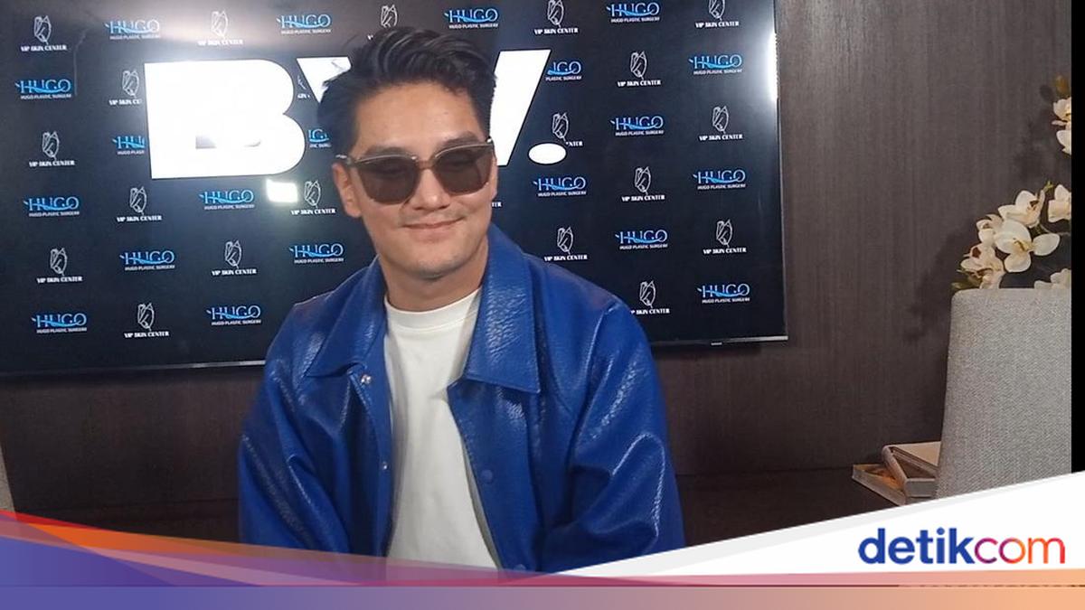Boy William Rogoh Kocek Rp 1,1 M untuk Operasi Plastik Hidung