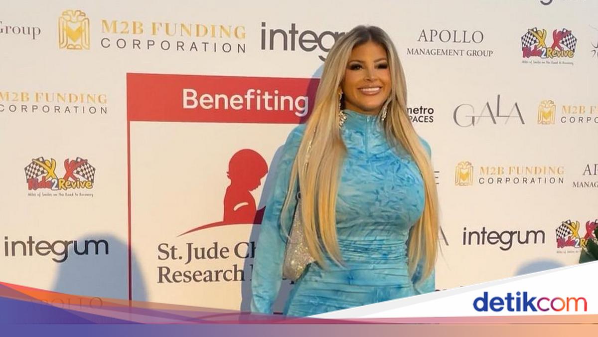 7 Potret Neyleen Ashley, Dulu Pemilik Payudara Terbesar Kini Lepas Implan