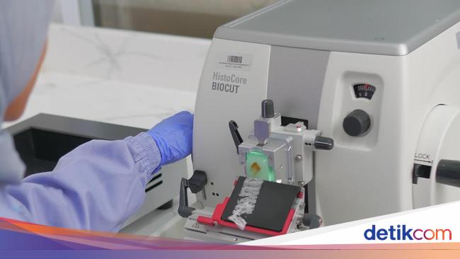 RS JIH Solo Buka Layanan Laboratorium Patologi Anatomi, Ini Keunggulannya