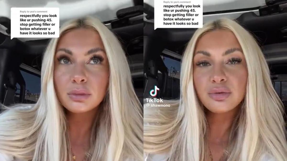 Viral Penampilan Wanita yang Keseringan Botox, Usia 22 Dikira Sudah 45 ...