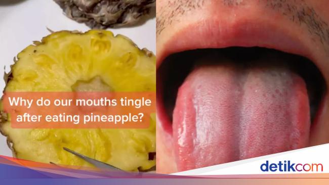 Lidah Terasa Digigit dan Kesemutan Usai Makan Nanas? Ternyata Ini Sebabnya Lidah Terasa Digigit dan Kesemutan Usai Makan Nanas? Ternyata Ini Sebabnya