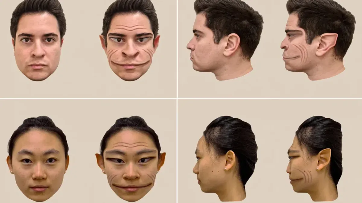 Kasus Langka Sindrom 'Wajah Iblis', Muka Semua Orang Terlihat Seperti Setan