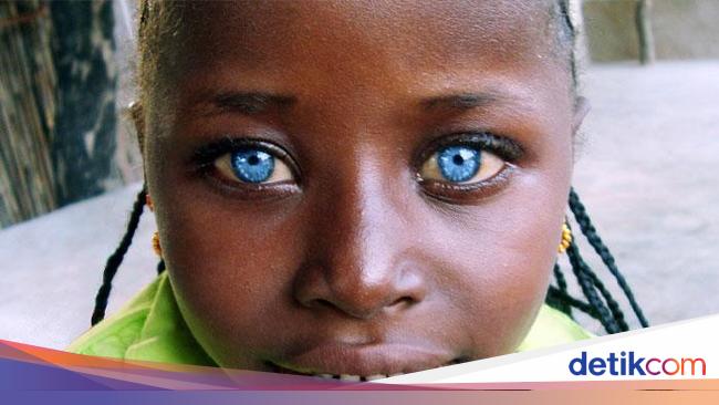 Keunikan Genetik yang Dimiliki Orang-orang di Dunia, Kamu Juga Punya?