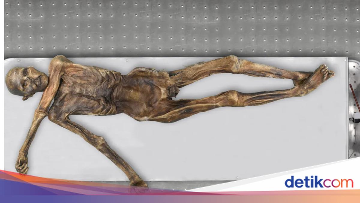 Mengejutkan! Ada Kehidupan Berusia Ribuan Tahun Tumbuh di Mumi Otzi