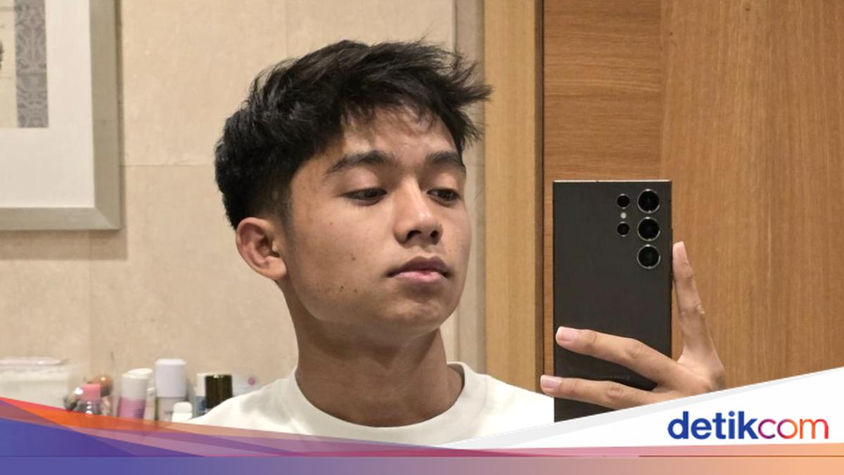 Betrand Peto Filler Dagu Demi Tampil Lebih Maskulin, Begini Hasilnya