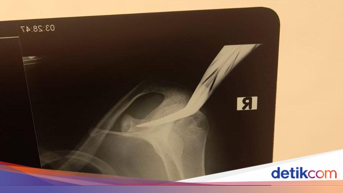 4 ABG Pembacok Ojol di Bantul Belum Ditetapkan Tersangka