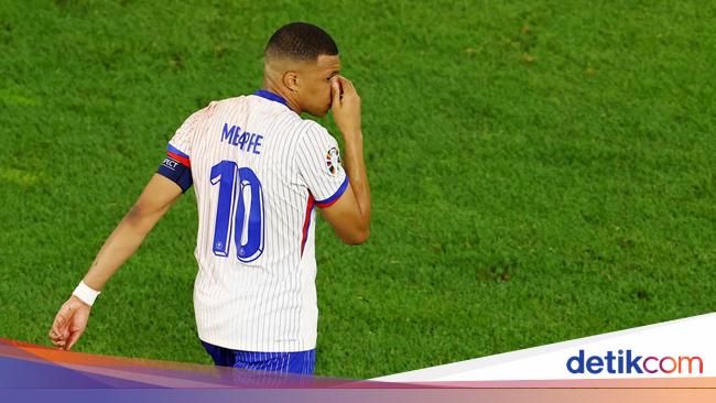 Mbappe Cari Topeng Usai Hidung Patah Lawan Austria