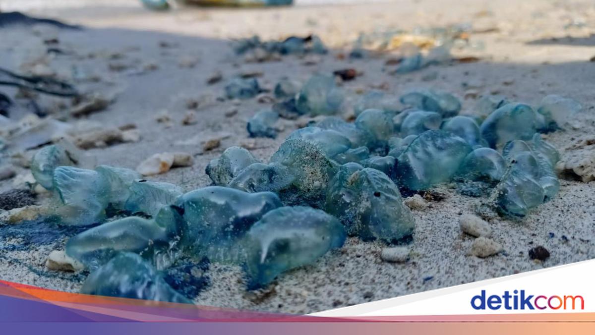 Jangan Pakai Air Kencing! Ini Cara Benar Atasi Sengatan Ubur-ubur Saat ...