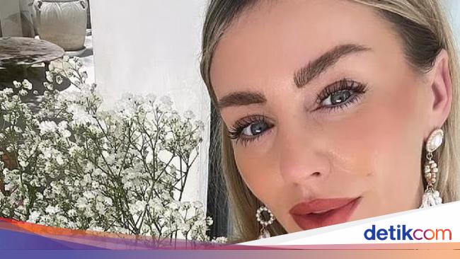 Bule Ahli Kecantikan Kecelakaan Horor di Bali, Nasibnya Viral Jadi Begini