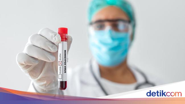 Fakta-fakta Clade 1b, Varian Mpox Mematikan yang Terdeteksi di Thailand