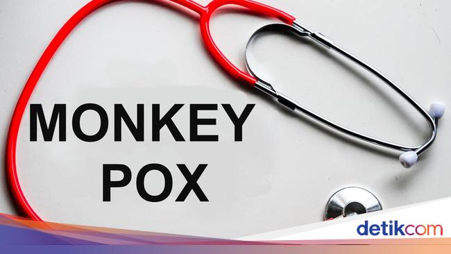 3 Jenis Obat Cacar Monyet yang Dipercepat Registrasi Masuk Indonesia