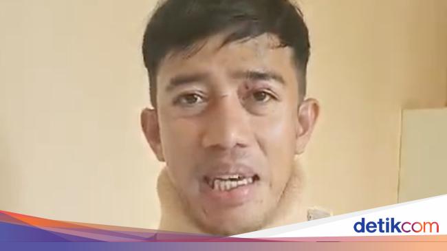 Ruri Repvblik Ungkap Kondisinya Seusai Kecelakaan Moge
