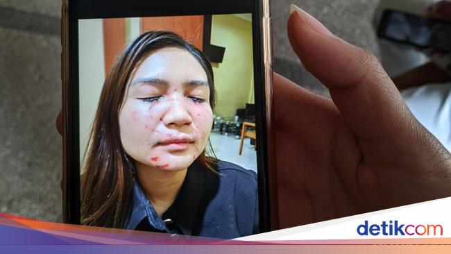Dua Alat Bukti yang Bikin Eks Suami Siri Selebgram Dwita Qorina Jadi Tersangka