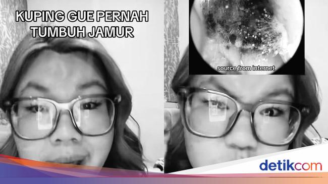 Viral Jamur Bersarang di Telinga Wanita Tangsel, Dokter THT Ungkap ...