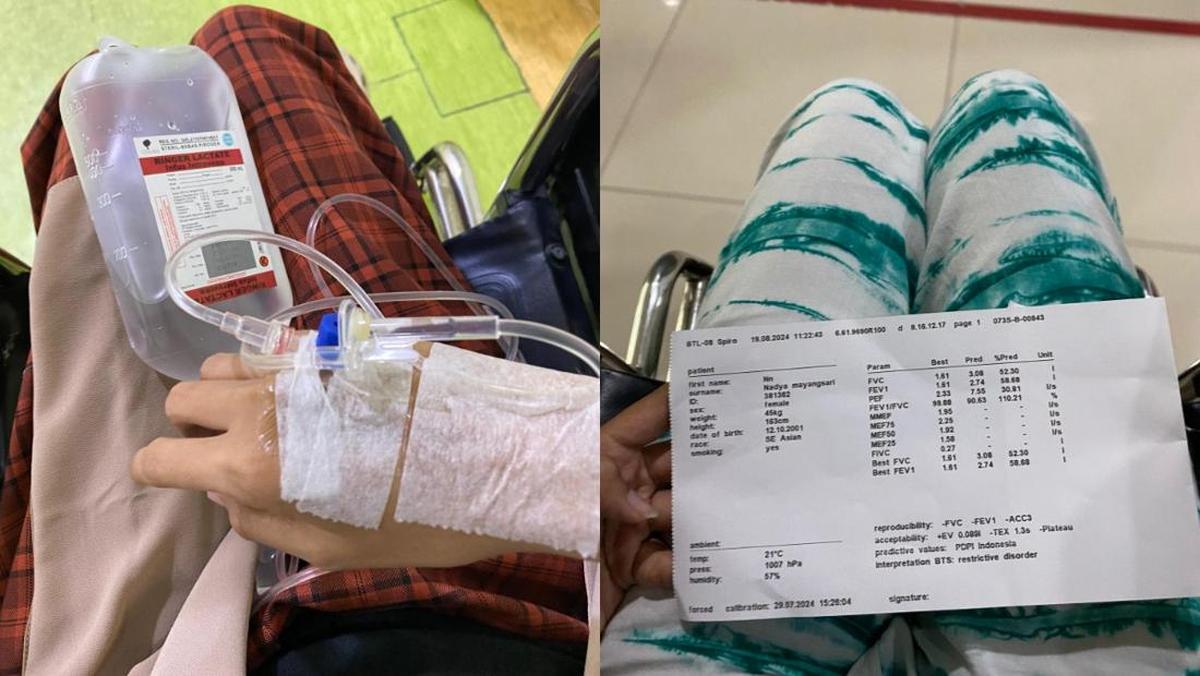 Curhat Wanita Jaktim Kena Pneumonia, Paru-parunya Kolaps gegara ...