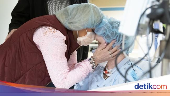 Pria AS Jalani Transplantasi Wajah, Mukanya Hancur usai Percobaan Bunuh Diri