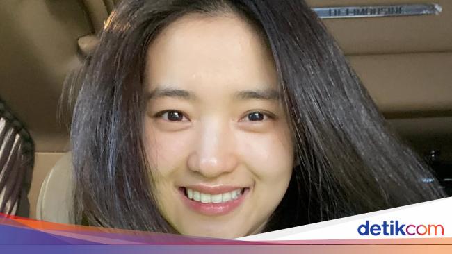 7 Potret Kim Tae Ri Pamer Wajah Tanpa Makeup, Tuai Pujian Cantik Natural