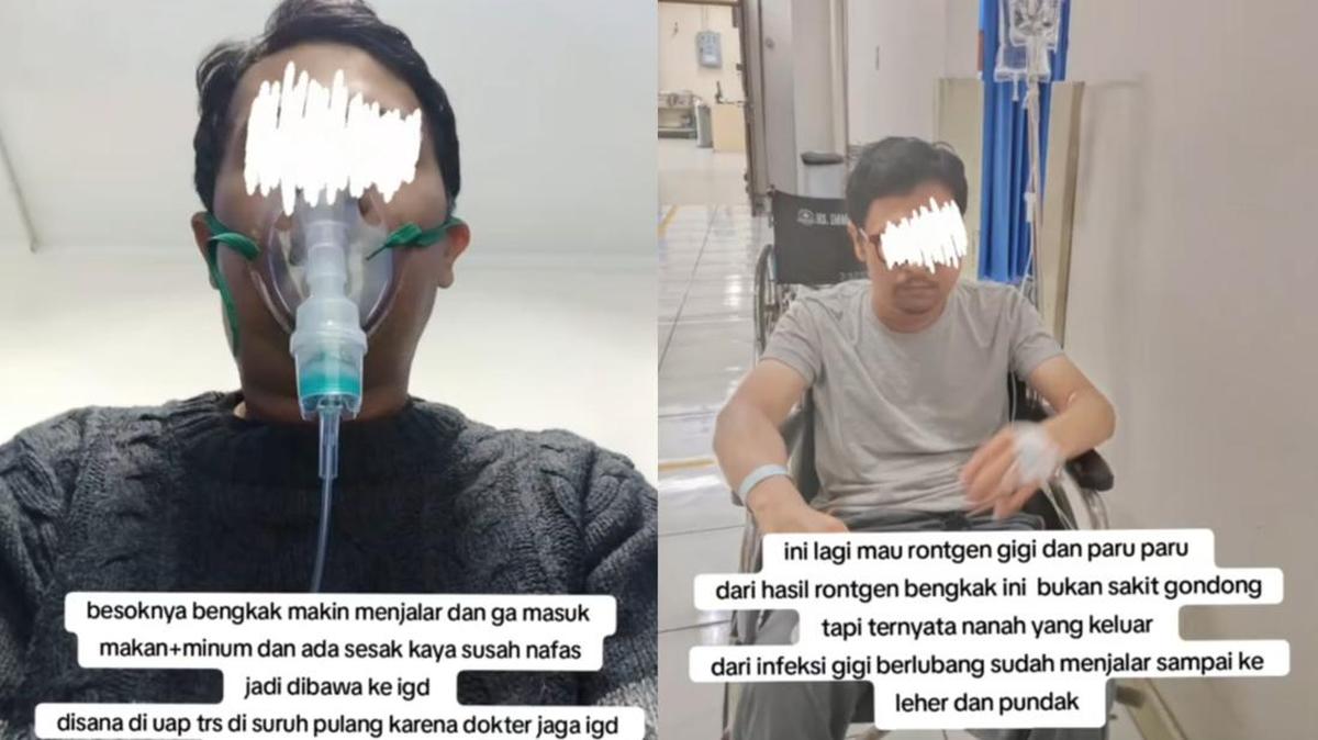 Awal Mula Pria di Bandung Meninggal gegara Gigi Berlubang, Ternyata Ada Infeksi