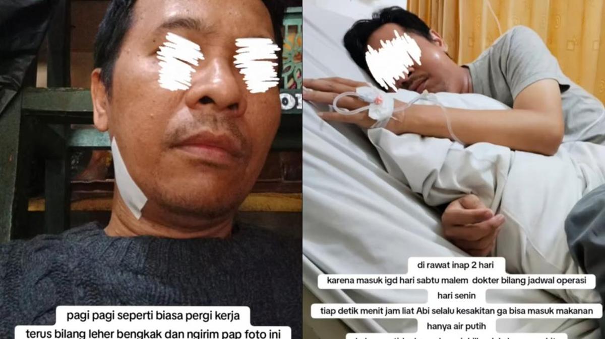 Infeksi pada Gigi Berlubang di Balik Kisah Pilu Kematian Pria di Bandung