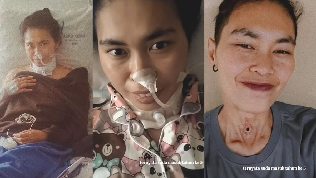 Awal Mula Wanita Salatiga Kena Kanker Laring Stadium 3, Ini Gejala yang ...