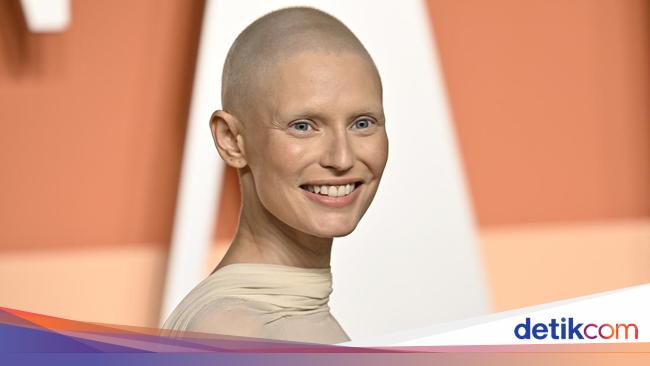 8 Potret Supermodel Tampil Botak Usai Kemoterapi Kanker