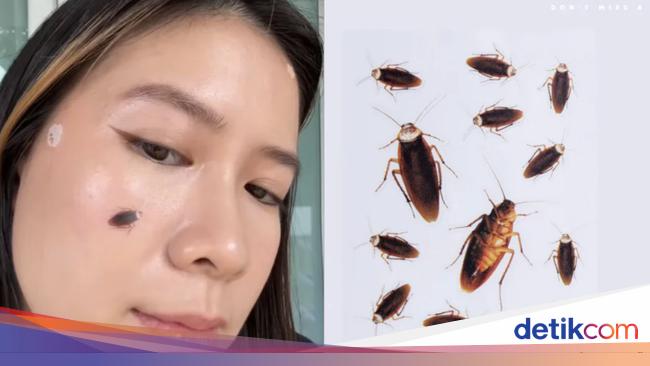 Bikin Merinding! Ada Acne Patch Bentuk Kecoa, Tampilannya Realistis