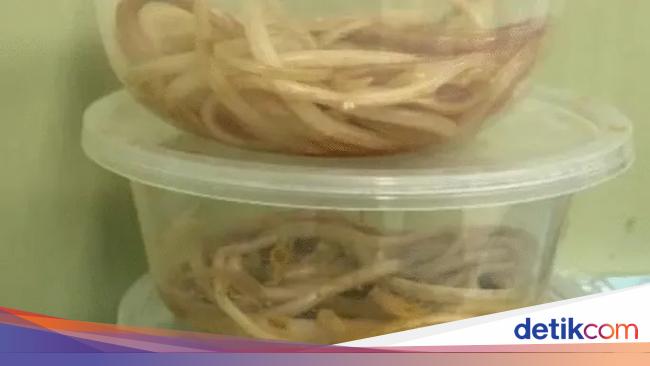 Balita di Jember Dioperasi, Dokter Keluarkan 3 Stoples Cacing dari Ususnya