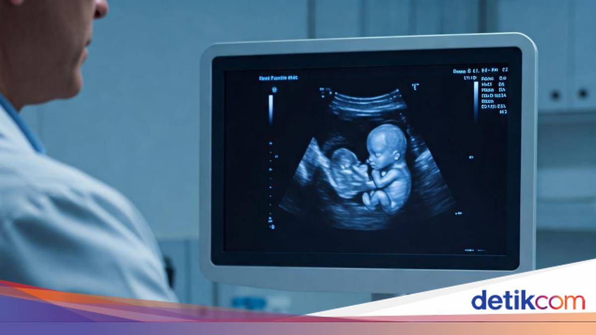 Tersibaknya Tabir Misteri Korban Dokter Cabul di Garut