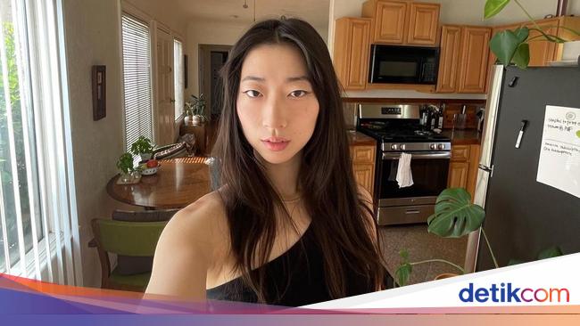 Kisah Wanita Mengaku Buta di Satu Mata Setelah Perawatan Kecantikan di Korea