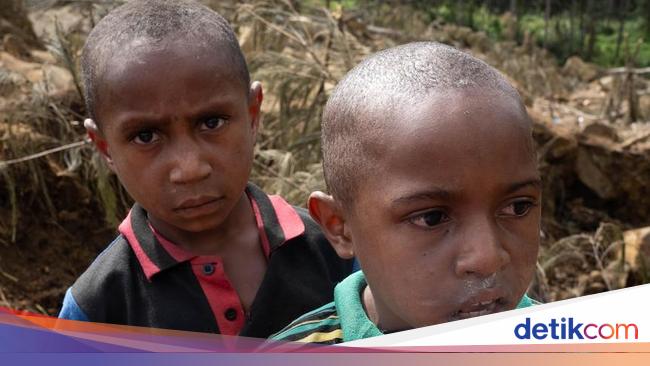 Dunia Hari Ini: Kasus Polio di Papua Nugini dari Virus yang Terhubung dengan Indonesia
