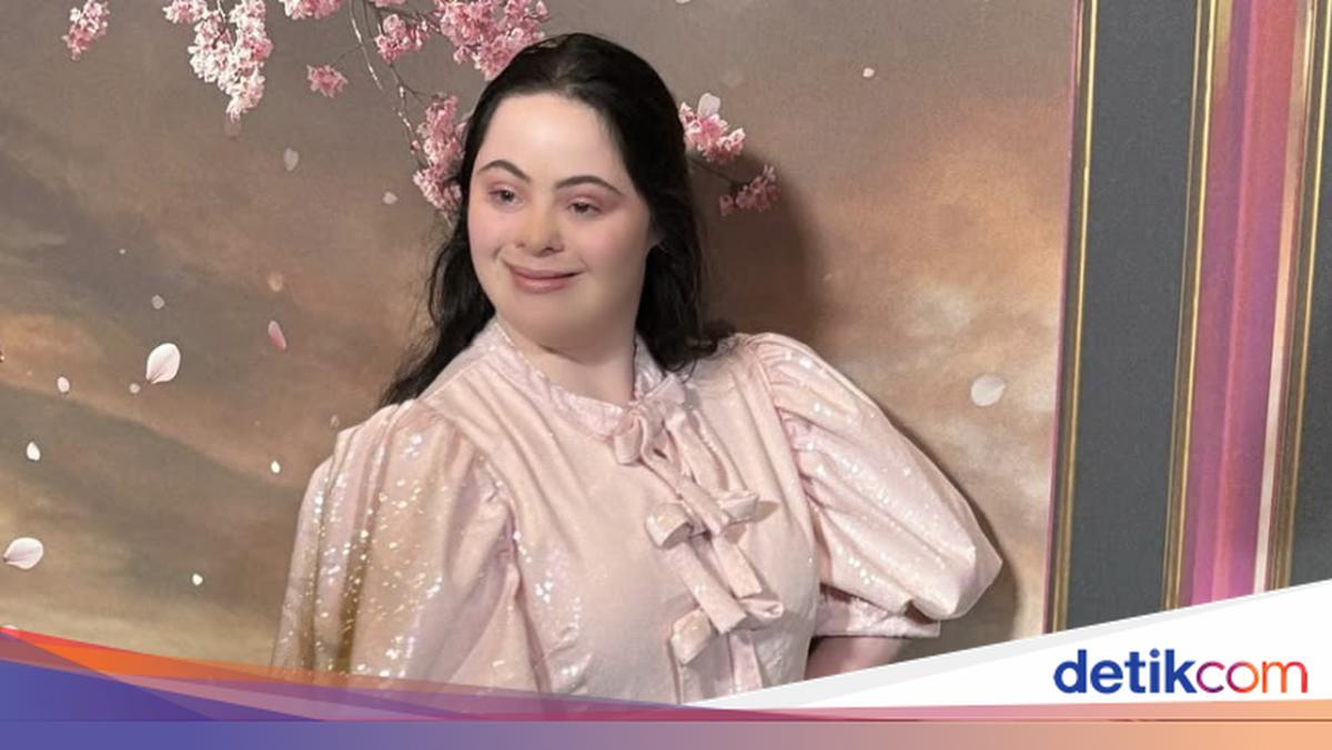 Kisah Model Down Syndrome yang Mendunia, Cetak Sejarah di Vogue Inggris