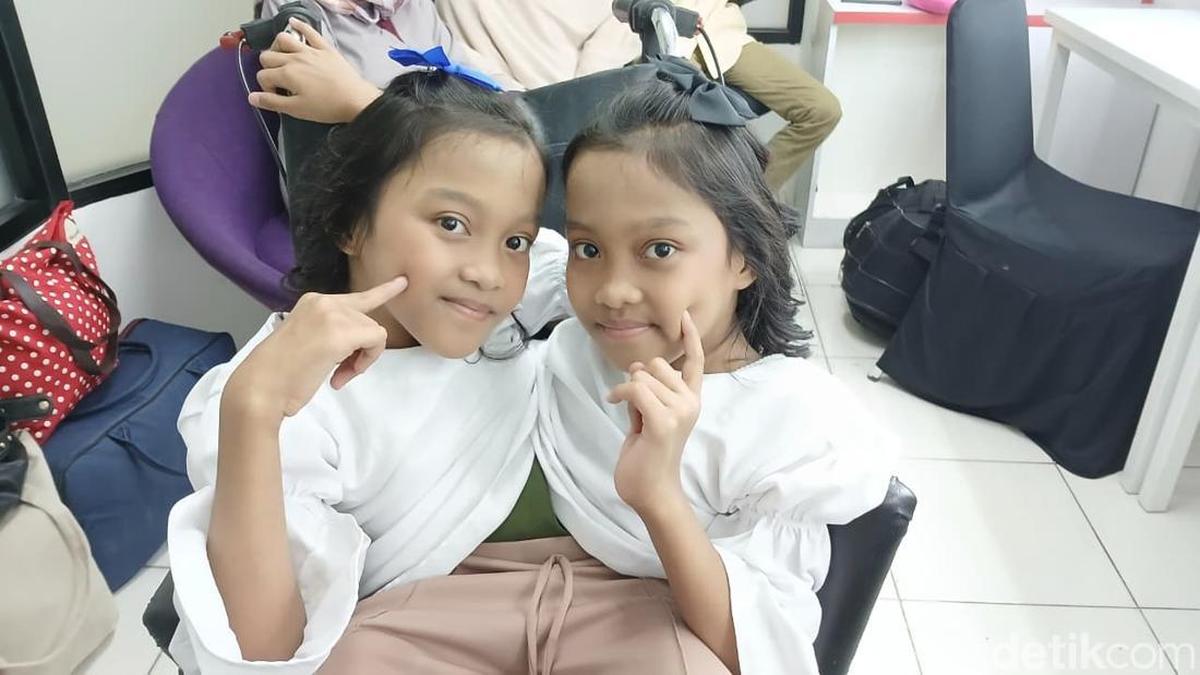 Semangat Kembar Siam Dewi-Putri asal Garut, Buktikan Tak Ada Batasan Meski Tubuh Menyatu