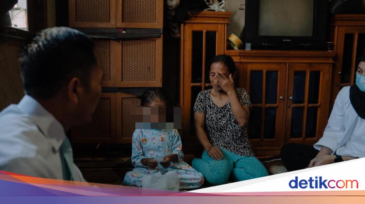 Bocah Palembang Bermata Lebam-Merah Usai Pulang Sekolah Ternyata Idap ...