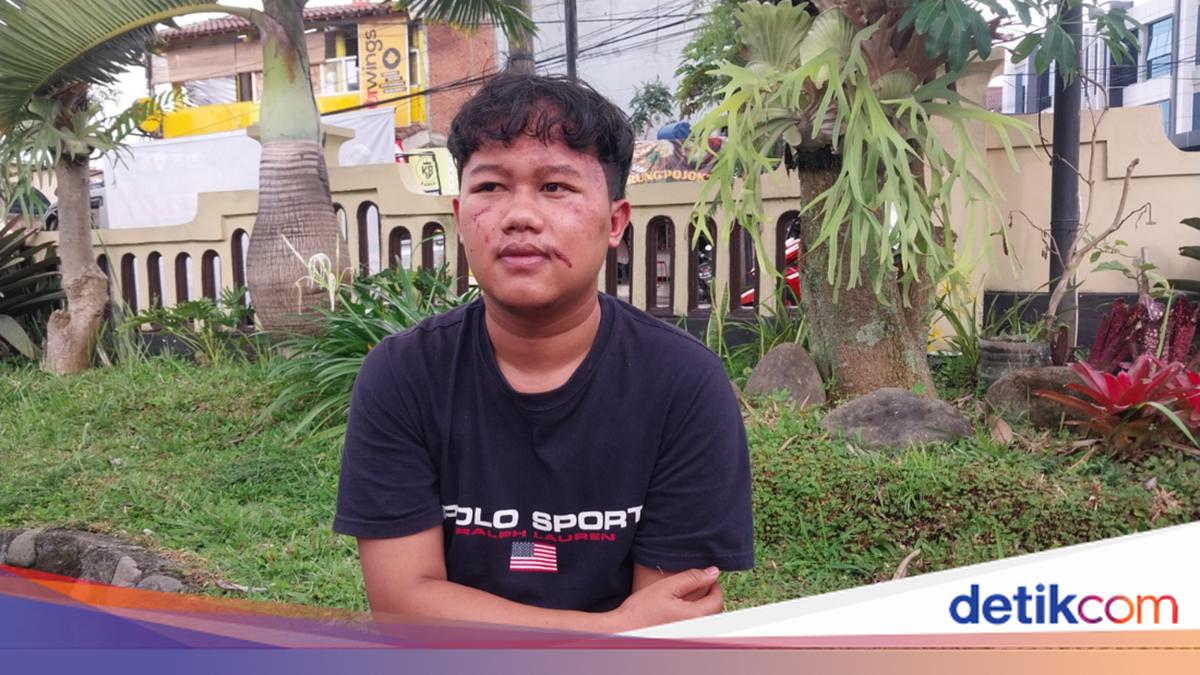 Korban Pengeroyokan Syok Ada Penonton Musik Underground Bawa Sajam