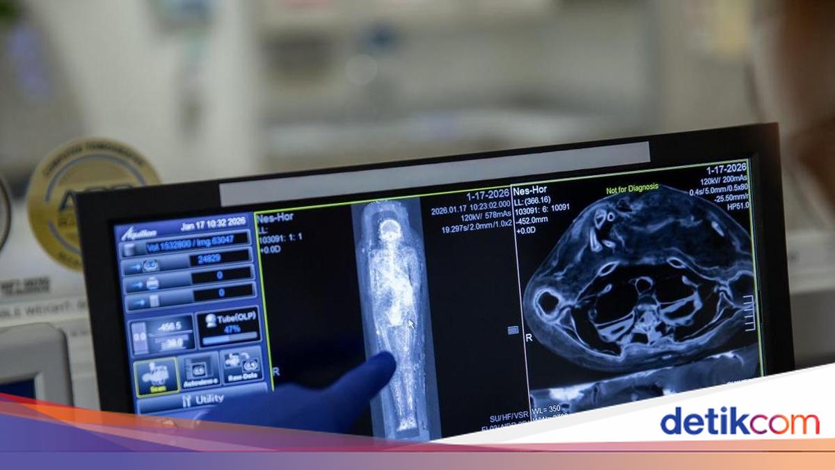Mumi Mesir Kuno Diteliti dengan CT Scan, Seperti Ini Bentuk Aslinya