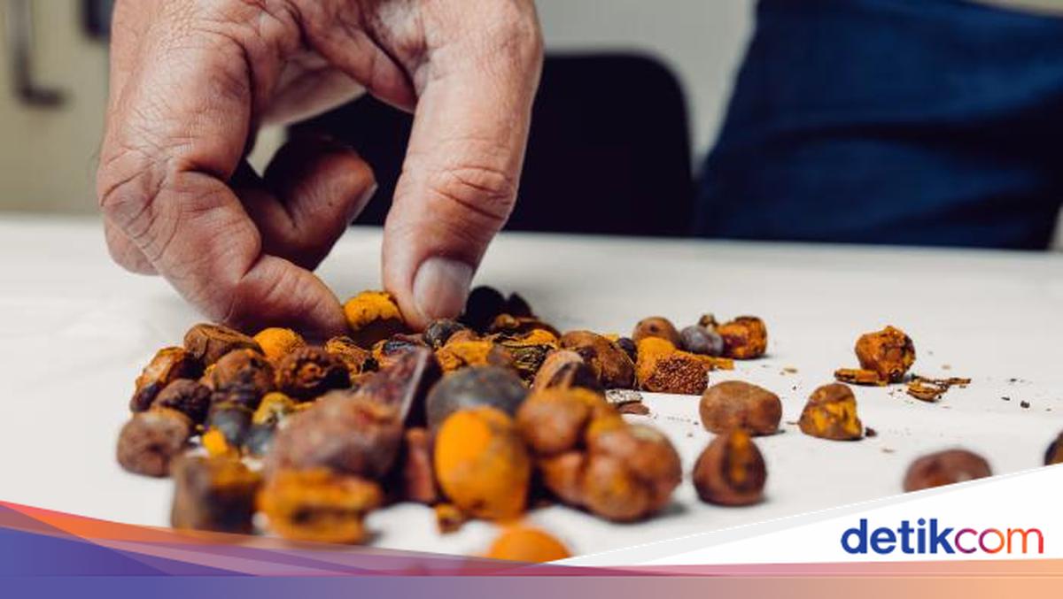 Batu Empedu Sapi Jadi Rebutan, Nilainya Kini Melampaui Emas!