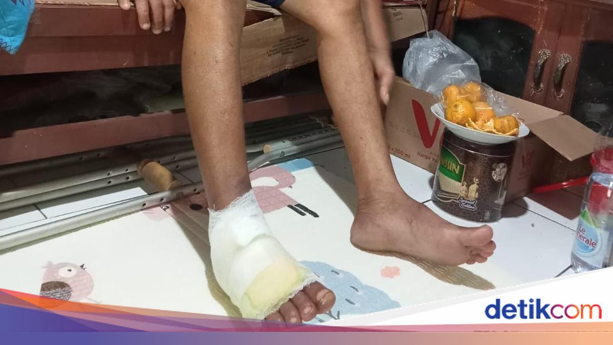 Kondisi Terkini Pencari Rumput di Brebes Korban Gigitan Ular Gibug