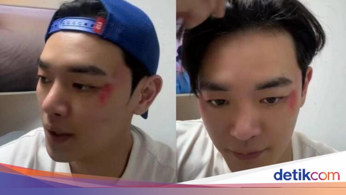 Jang Dong Joo Ungkap Alasan Pensiun di Usia 31, Terlilit Utang Hingga ...