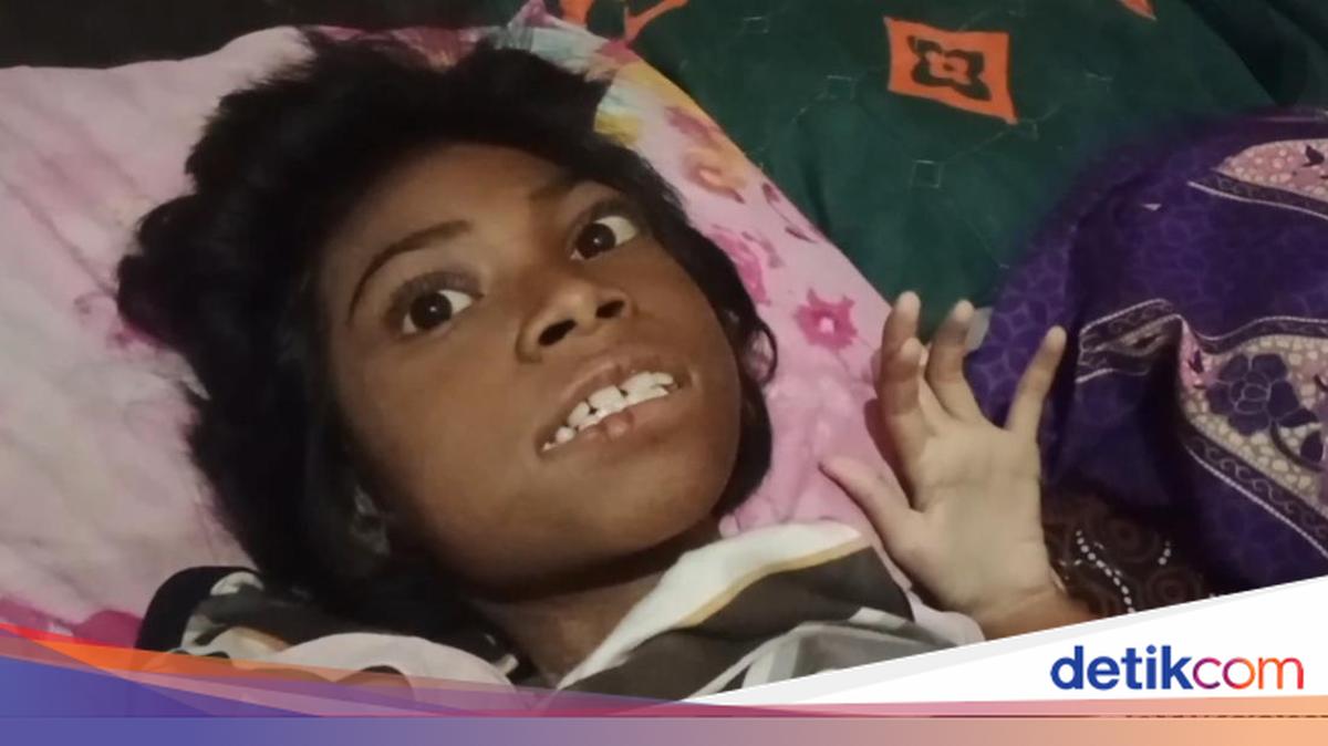 Yati Bertahan demi Menjaga Senyuman Anak Cerebral Palsy