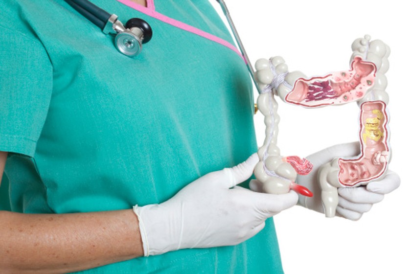 Ini Dia Biaya Operasi Usus Buntu di Beberapa Rumah Sakit