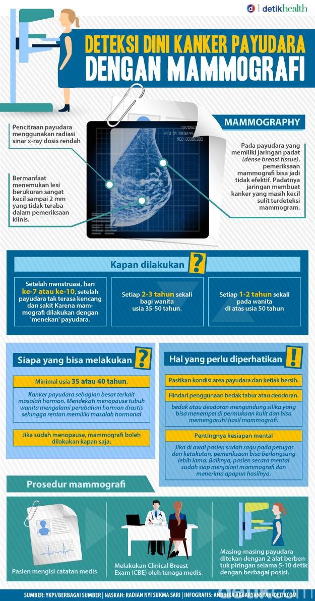 Infografis: Deteksi Dini Kanker Payudara dengan Mammografi