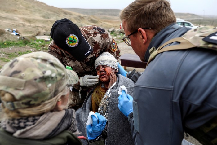 Lagi Anak Anak Jadi Korban Perang Isis