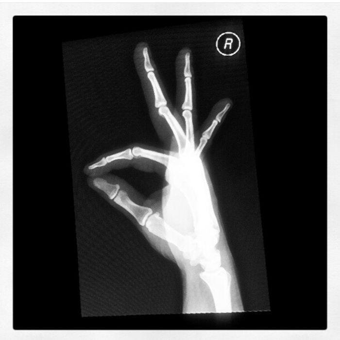 8 Foto Rontgen Unik yang Bisa Bikin Ketawa - Foto 3