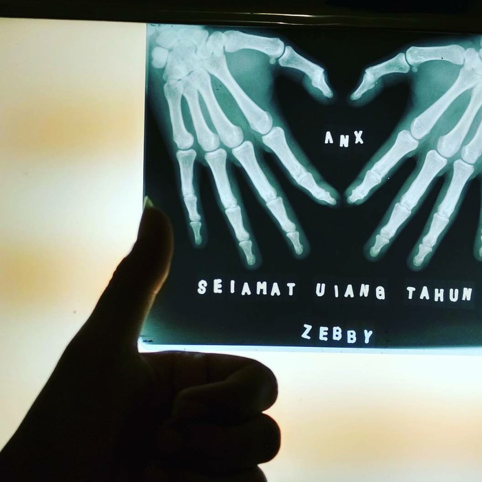 8 Foto Rontgen Unik yang Bisa Bikin Ketawa