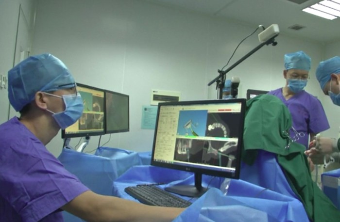 Foto: Prosedur Pemasangan Implan Gigi oleh Robot di Cina