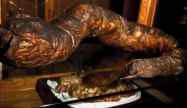 Inikah Otaknya Albert Einstein?