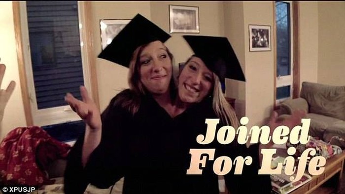 Potret Kehidupan Sehari-hari si Kembar Dempet Abby dan Britany