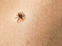 Parah! Ada Kutu Parasit di Kue Ini