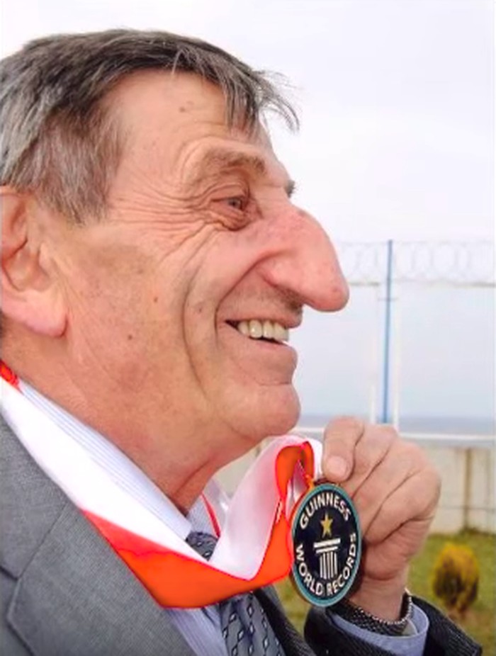 Wow, Ini Mehmet Ozyurek Pemilik Hidung Terbesar dan Termancung di Dunia!